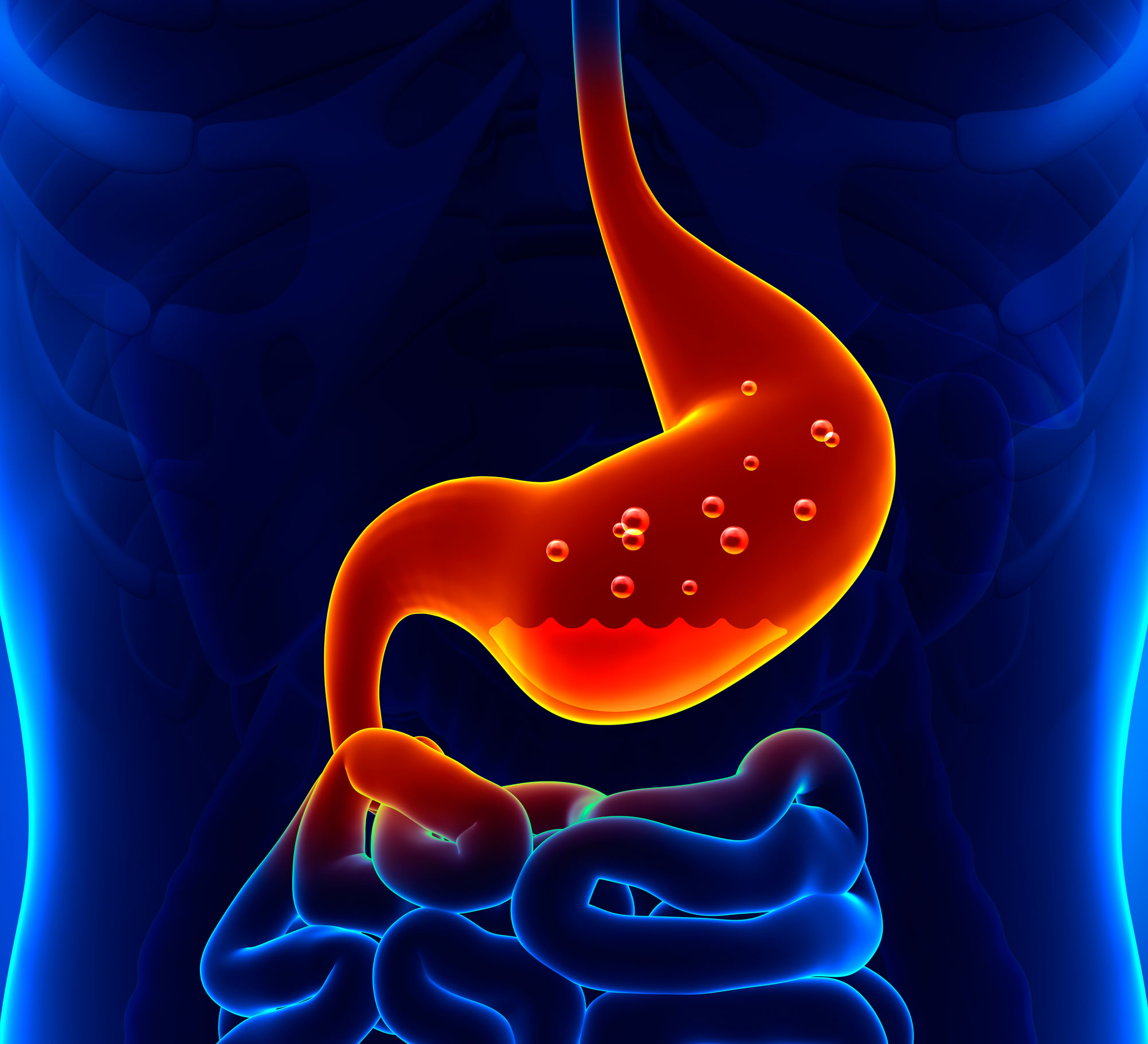 Reflusso gastro-esofageo: sintomi, dieta e cure - Humanitas
