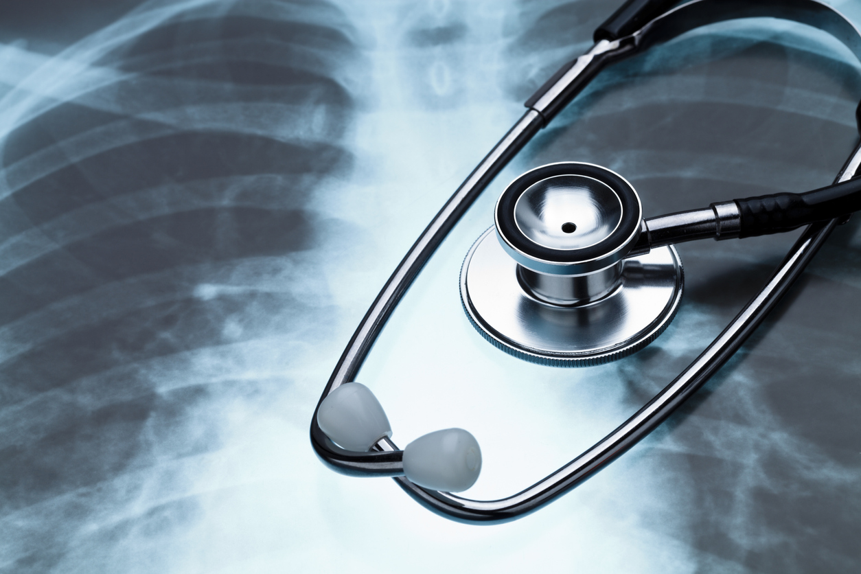 TAC torace nei fumatori: a cosa serve e perché è fondamentale - Humanitas