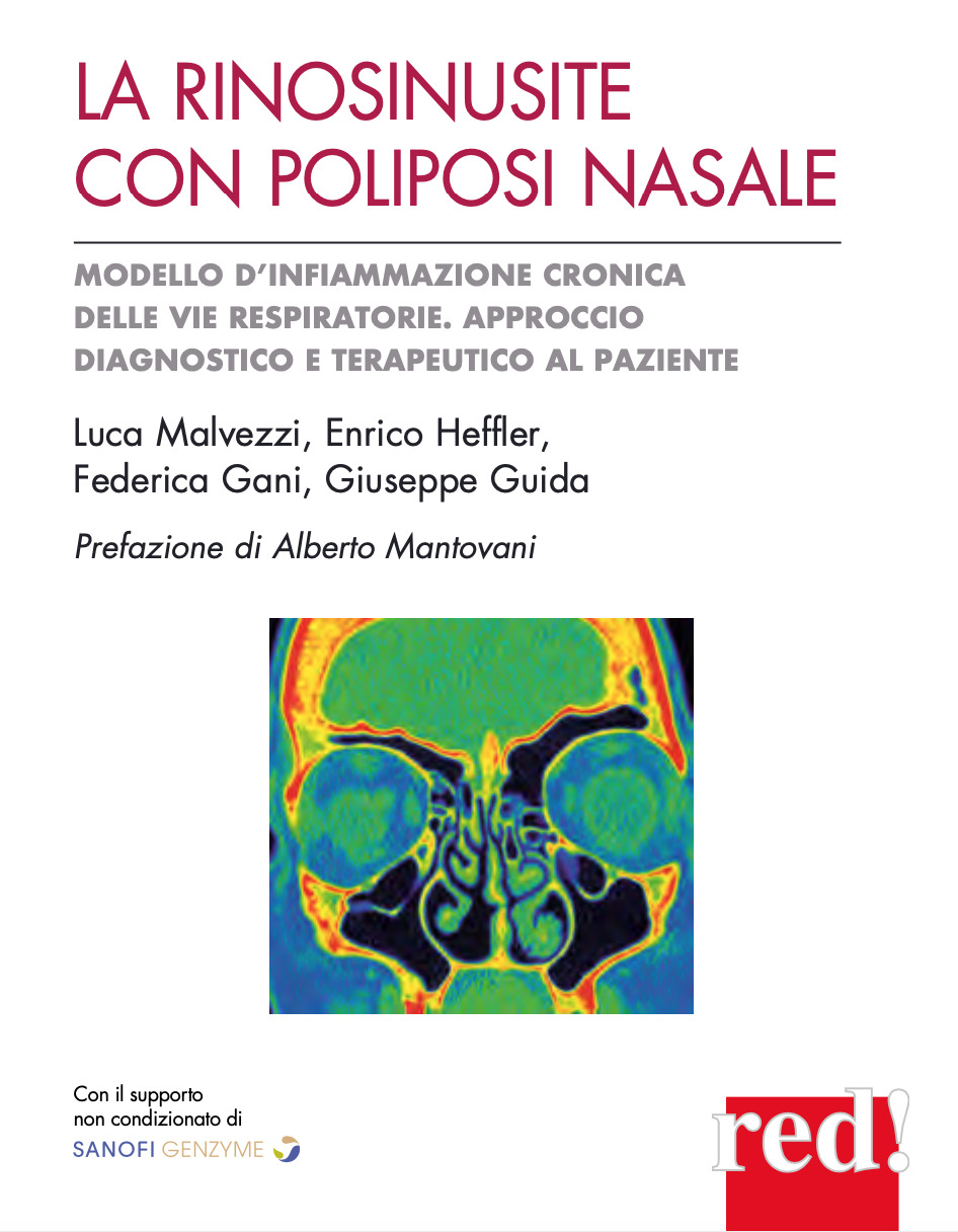 “La rinosinusite con poliposi nasale”: dagli specialisti Humanitas un ...